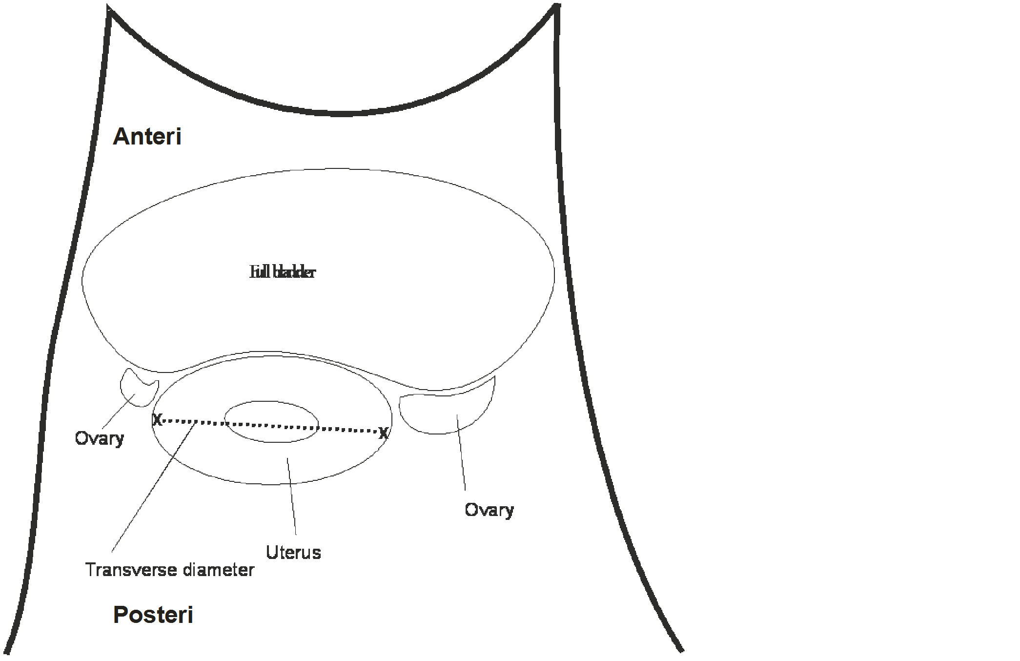 Sonographic Evaluation of the Normal Uterine Size and Volume Amongst ...